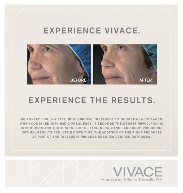 Vivace™ Microneedling RF Palm Beach Gardens, Port St. Lucie, and Jupiter FL